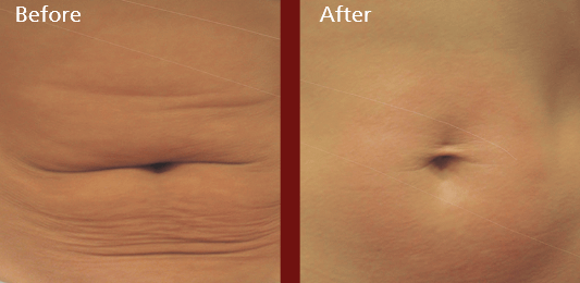 FORMA PLUS - Skincare Laser Center